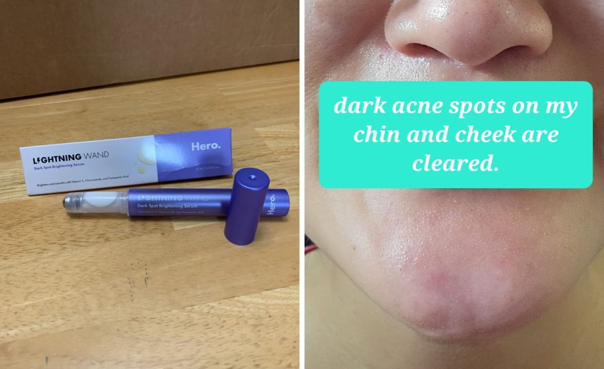 Instantly Transform Your Skin: Meet the Hero Cosmetics Lightning Wand ...