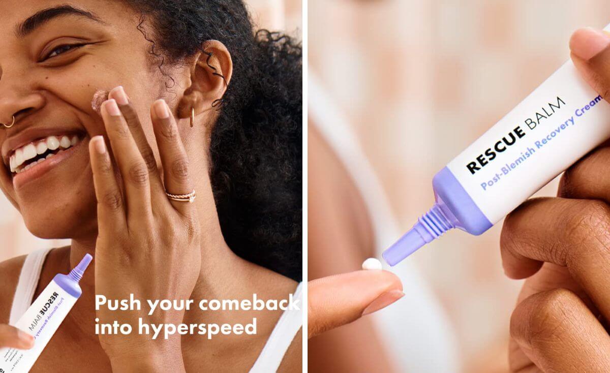 Say Goodbye to Blemishes with Hero Cosmetics' Rescue Balm - The Post ...